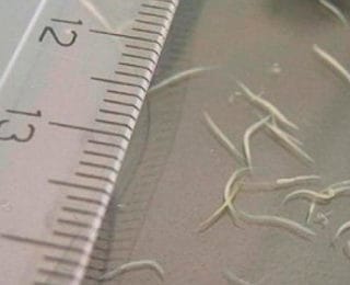 Kıl Kurdu Nedir, Nasıl Bulaşır, Belirtileri ve Tedavi Yöntemleri Nelerdir